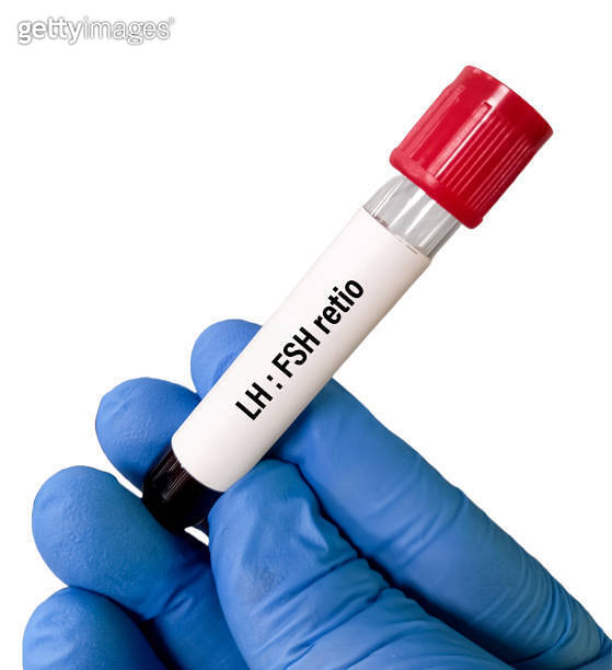 Blood sample tube for LH (Luteinizing hormone) and FSH (Follicle ...