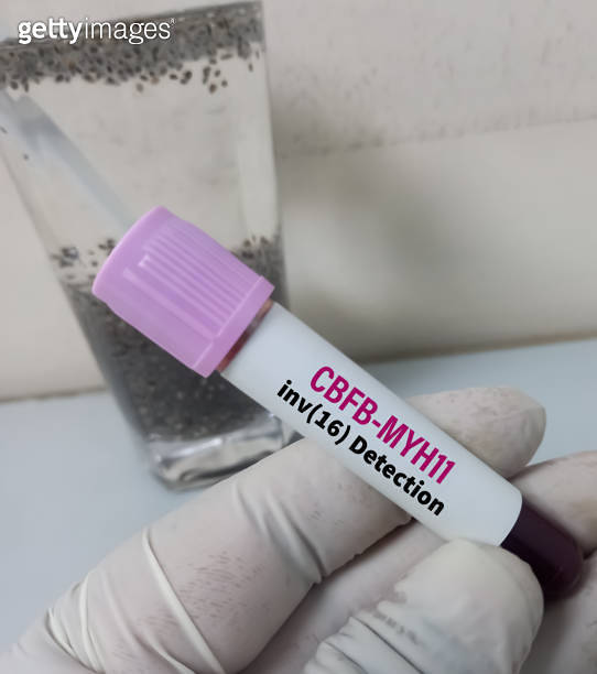 CBFB-MYH11 inv(16) test, to monitor for minimal residual disease. 이미지 ...