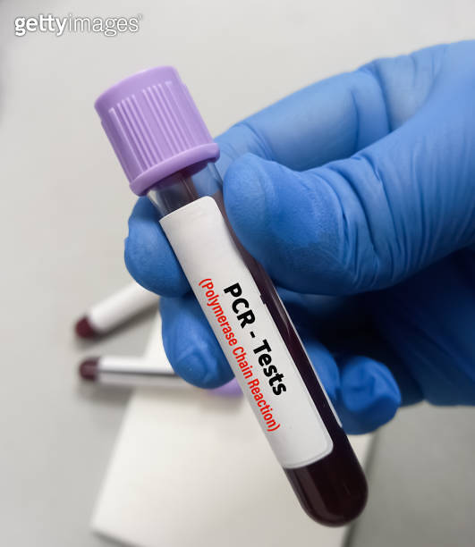 Blood sample for PCR(polymerase chain reaction) Tests, finding the DNA ...