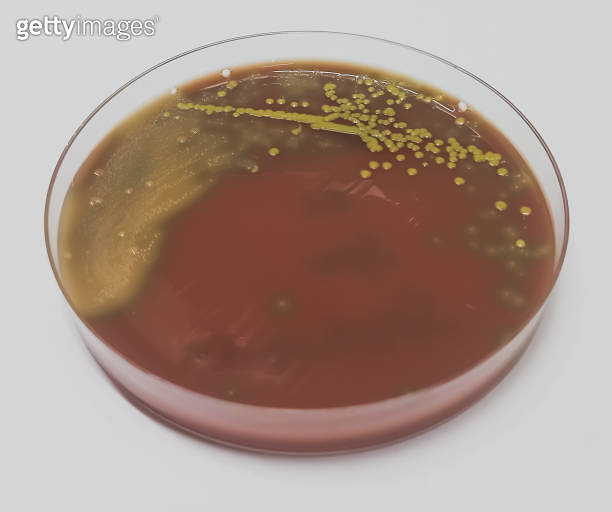 Golden color colonies on chocolate agar medium, growth of ...