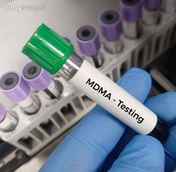 Blood sample for MDMA (Methylenedioxymethamphetamine) also known as ...
