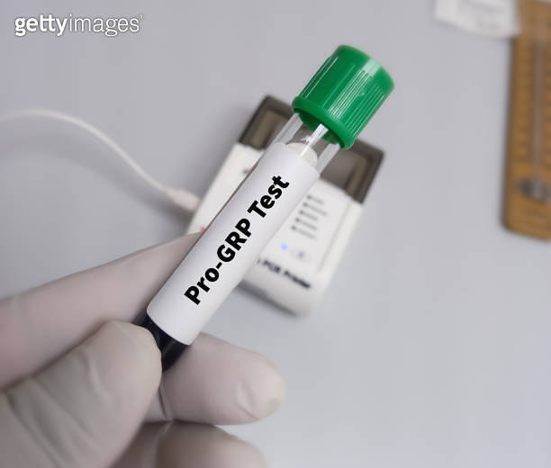 Blood sample for proGRP (Pro-Gastrin-releasing peptide) test, marker ...