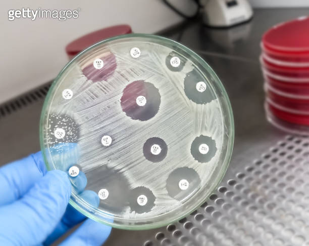 Antimicrobial susceptibility testing in culture plate. Drug sensitivity ...