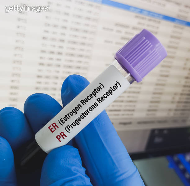 Blood sample for ER and PR PCR testing for breast cancer diagnosis ...