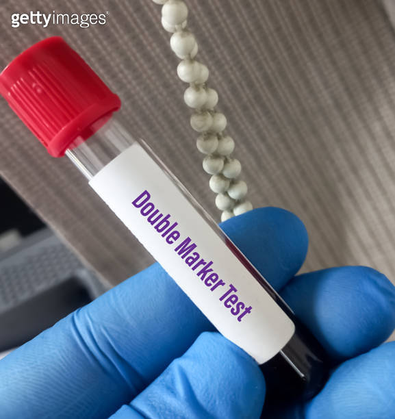 Double Marker Test. Pregnancy marker. Maternal serum screening ...