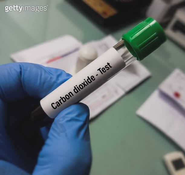 Hand holding blood sample for Carbon dioxide(CO2) Test 이미지 (1769621476 ...