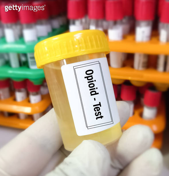 Urine sample for Opioid drug test. 이미지 (1769638466) - 게티이미지뱅크