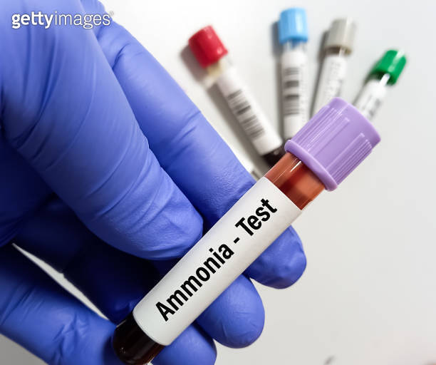 Blood sample for Ammonia test to diagnosis of ammonia levels also known ...