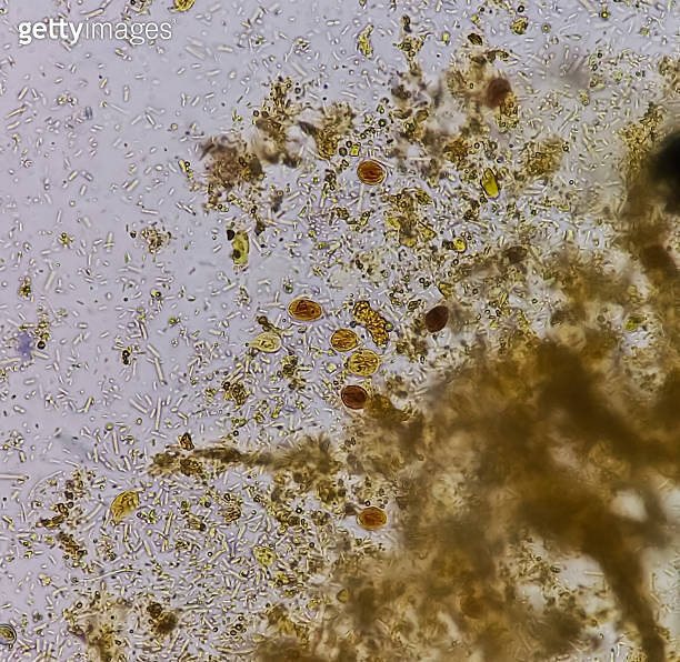 Giardia lamblia cysts and Trophozoite form, muscle fiber in stool ...