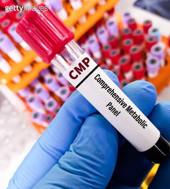 Blood sample tube for analysis of CMP or Comprehensive Metabolic Panel ...