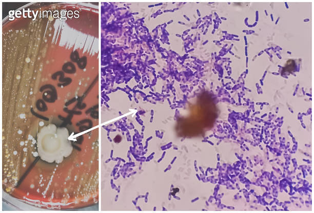 Yeast Infection Budding Yeast And Pseudohyphae Of Candida Albicans Grams Stain This Fungus