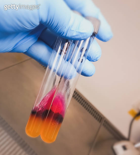 Salmonella detection method by using Triple Sugar Iron (TSI) Agar in ...