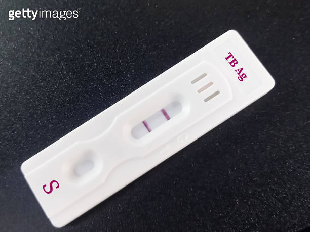Rapid test device or kit for Tuberculosis (TB) test. ICT for TB. show ...