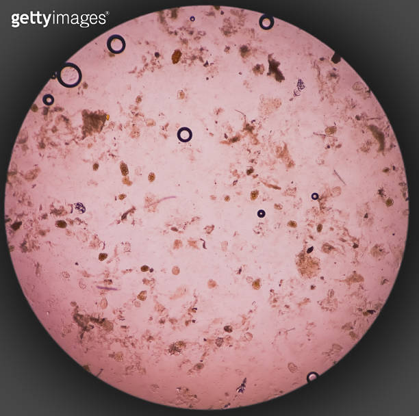 Giardia lamblia cysts and Trophozoite form, muscle fiber in stool ...