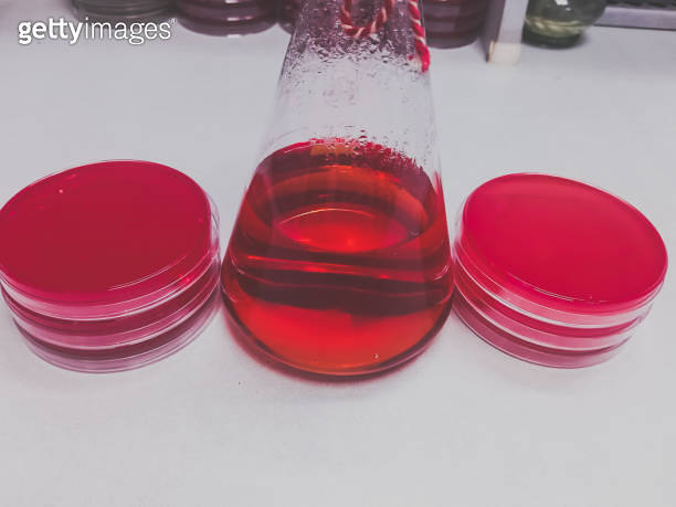 Biochemical test, microbiological liquid media. Blood agar plate ...