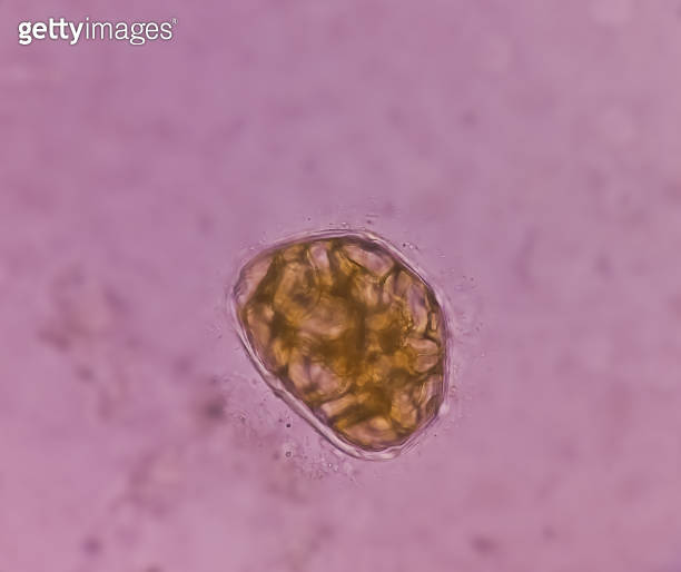 Giardia lamblia cysts and Trophozoite form, muscle fiber in stool ...