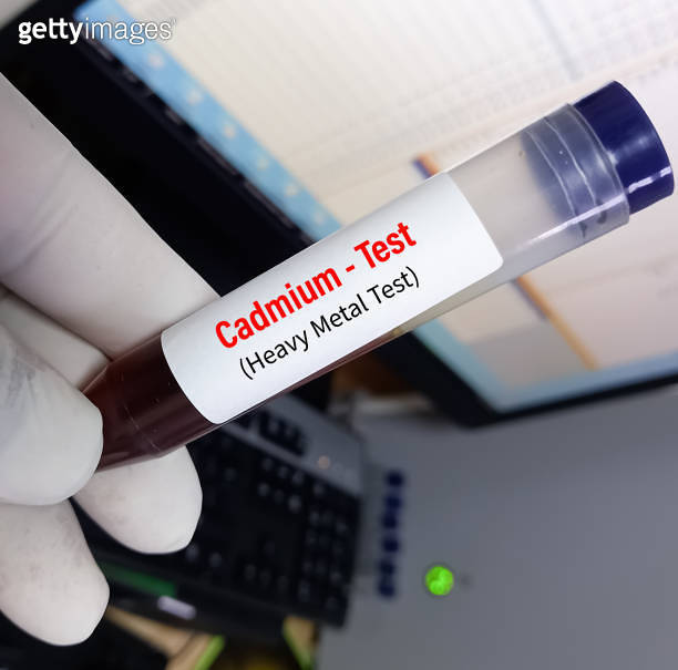 Urine sample for cadmium (heavy metal) test, toxic metal. (1498324455 ...