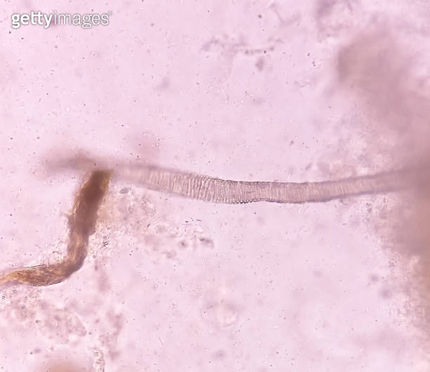 Intestinal Worms in stool examination, under 40X light microscope ...