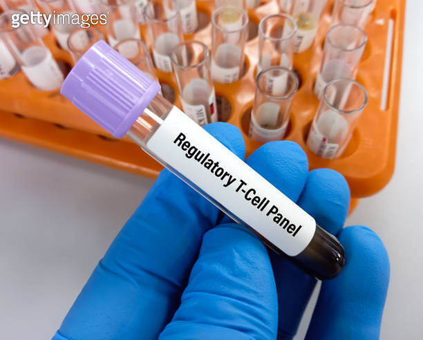 Scientist hold blood sample for Regulatory T cells panel or Tregs cells ...