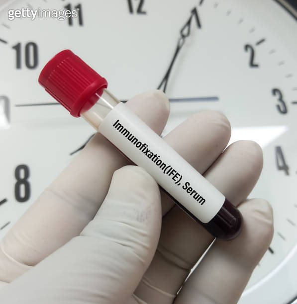 Blood sample for Immunofixation (IFE) test, is a blood test used to ...