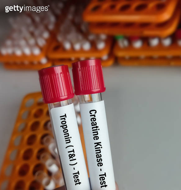 Blood sample for Troponin and Creatine kinase test to diagnosis of ...
