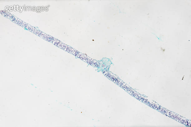 plant pittospora leaf c.s. under light mircoscope with white background ...