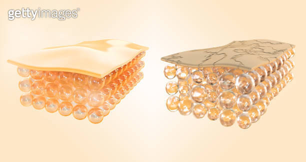 Structure of healthy and damaged skin, normal and dry 3d render set ...