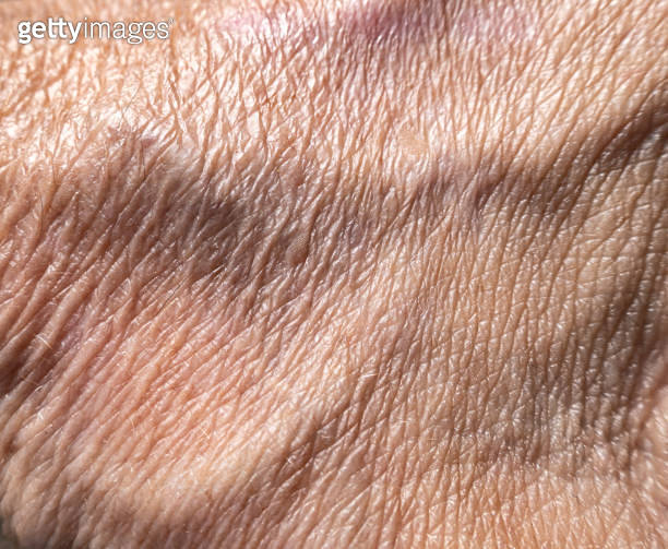 Wrinkled skin texture 이미지 (1704163388) - 게티이미지뱅크