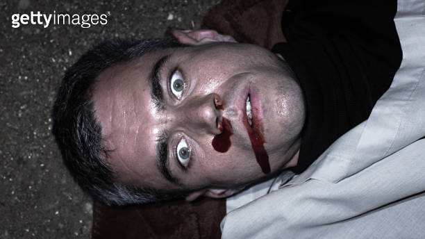 Forensic Photo Taken at Crime scene: Face of Victim's Corpse Frozen in ...