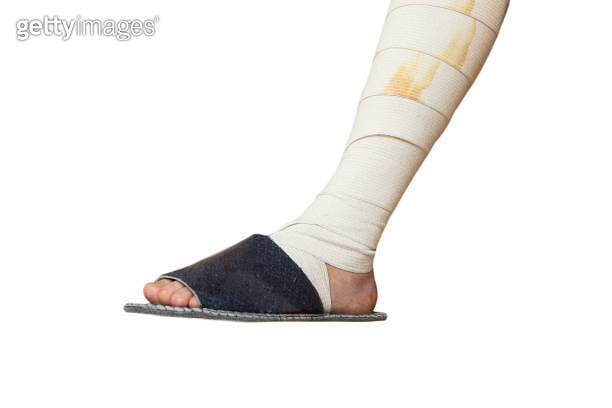 One male leg bandaged with an elastic bandage after knee surgery in ...