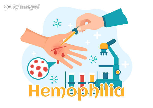 Hemophilia Vector Illustration with Doctor Examining Injured Knee or ...