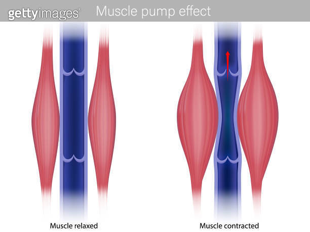 Skeletal Muscle pump effect. Illustration of muscle pump effect on ...