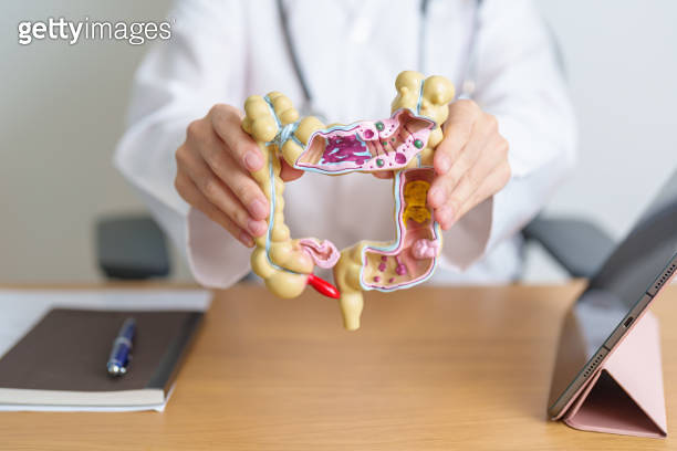 Doctor with human Colon anatomy model and tablet. Colonic disease ...
