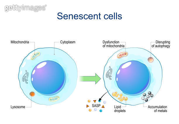 Senescent cells. Cellular senescence 이미지 (1833216406) - 게티이미지뱅크
