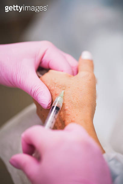 Close-up of a female doctor hand during a subcutaneous injection ...