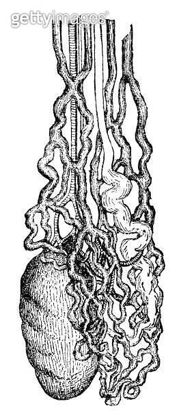 Medical Illustration of a Human Testicle and Spermatic Veins with ...