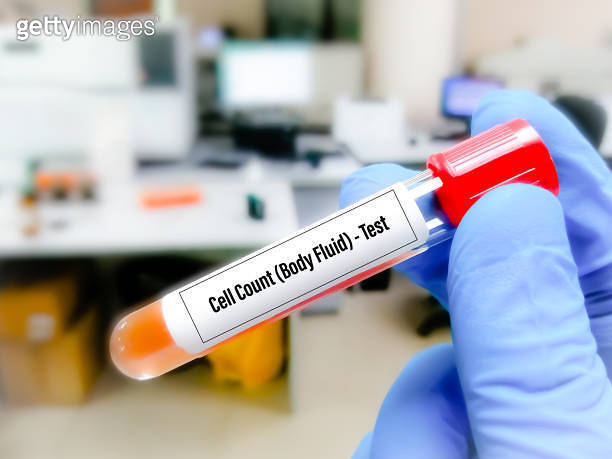 Body fluid sample on scientist hand for Cell count testing. 이미지 ...