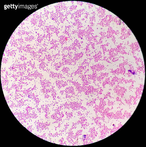 Salmonellosis: microscopic view of gram stained slide from blood agar ...