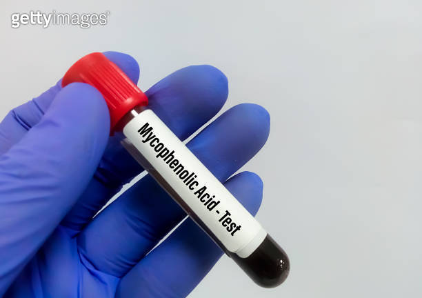 Blood sample for Mycophenolic Acid (MPA) test, to set therapeutic range ...