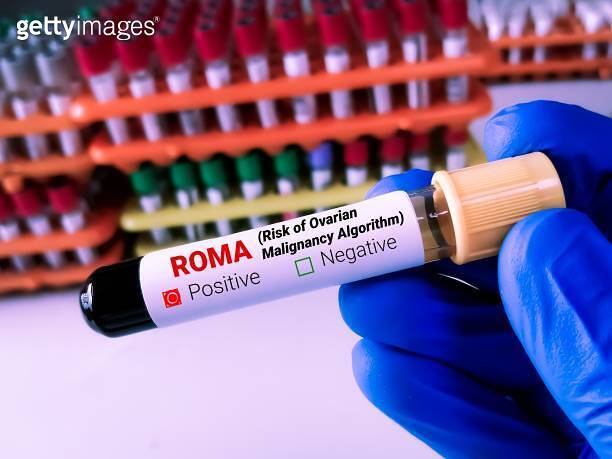 Blood sample tube for analysis of a risk of ovarian malignancy ...