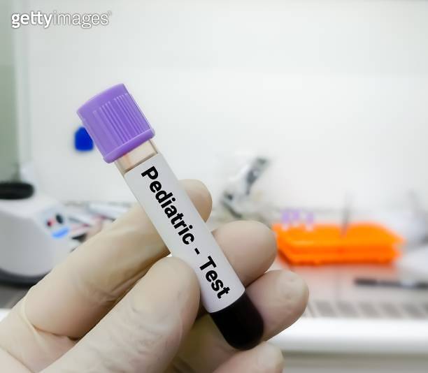 Doctor holding a blood sample for Pediatric test. 이미지 (1811369108) - 게티 ...
