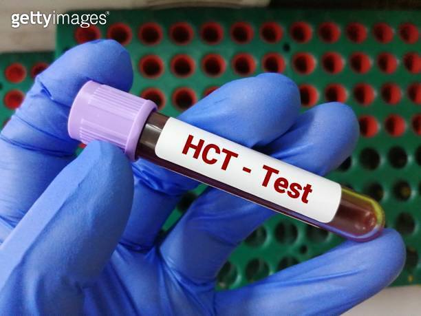 Blood sample for hematocrit (HCT) or Pack cell volume (PCV) test. 이미지 ...