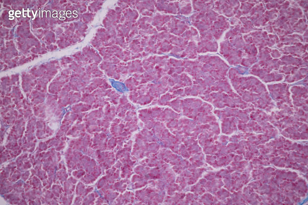 Histological Pancreas human, Liver human, Vermiform appendix human and ...