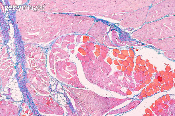 Adipose tissue human, Soft palate human, Bone human and Striated ...