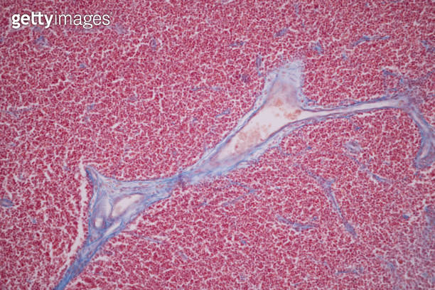 Thyroid gland and Thymus gland human Child under the microscope for ...