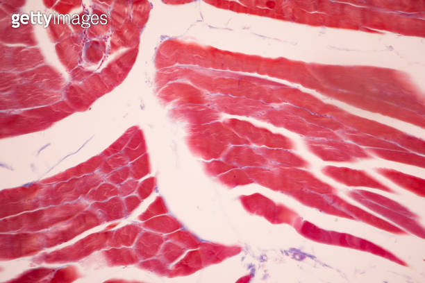 Striated muscle human under the microscope. 이미지 (1559511114) - 게티이미지뱅크