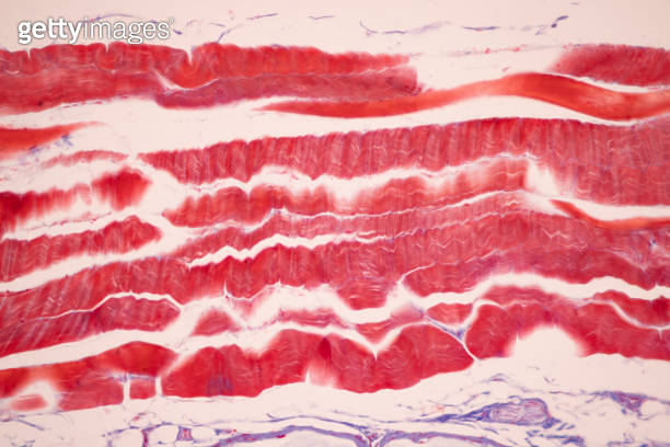 Striated muscle human under the microscope. 이미지 (1559511623) - 게티이미지뱅크