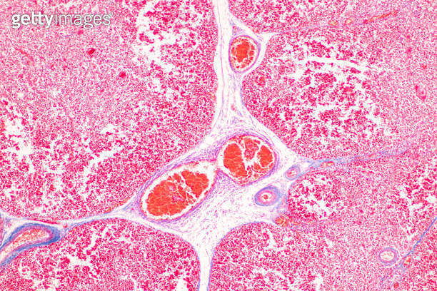 Trachea, Thymus, Parathyroid gland and Tonsil human under the ...