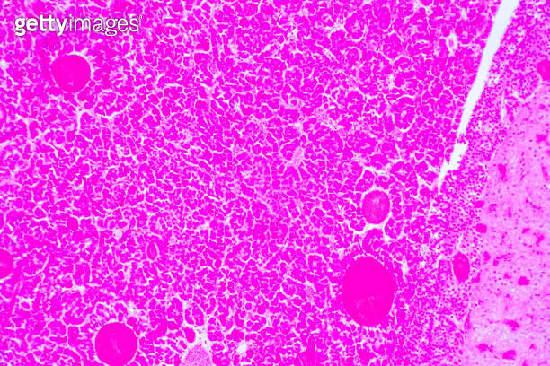 Tissue of Thyroid gland, Lymph gland, Larynx of human and Human blood ...