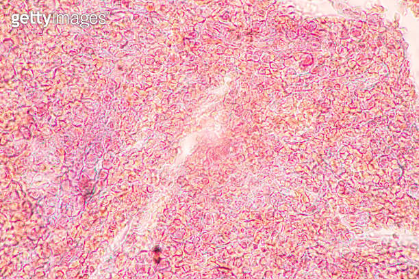 Tissue of Thyroid gland, Lymph gland, Larynx of human and Human blood ...